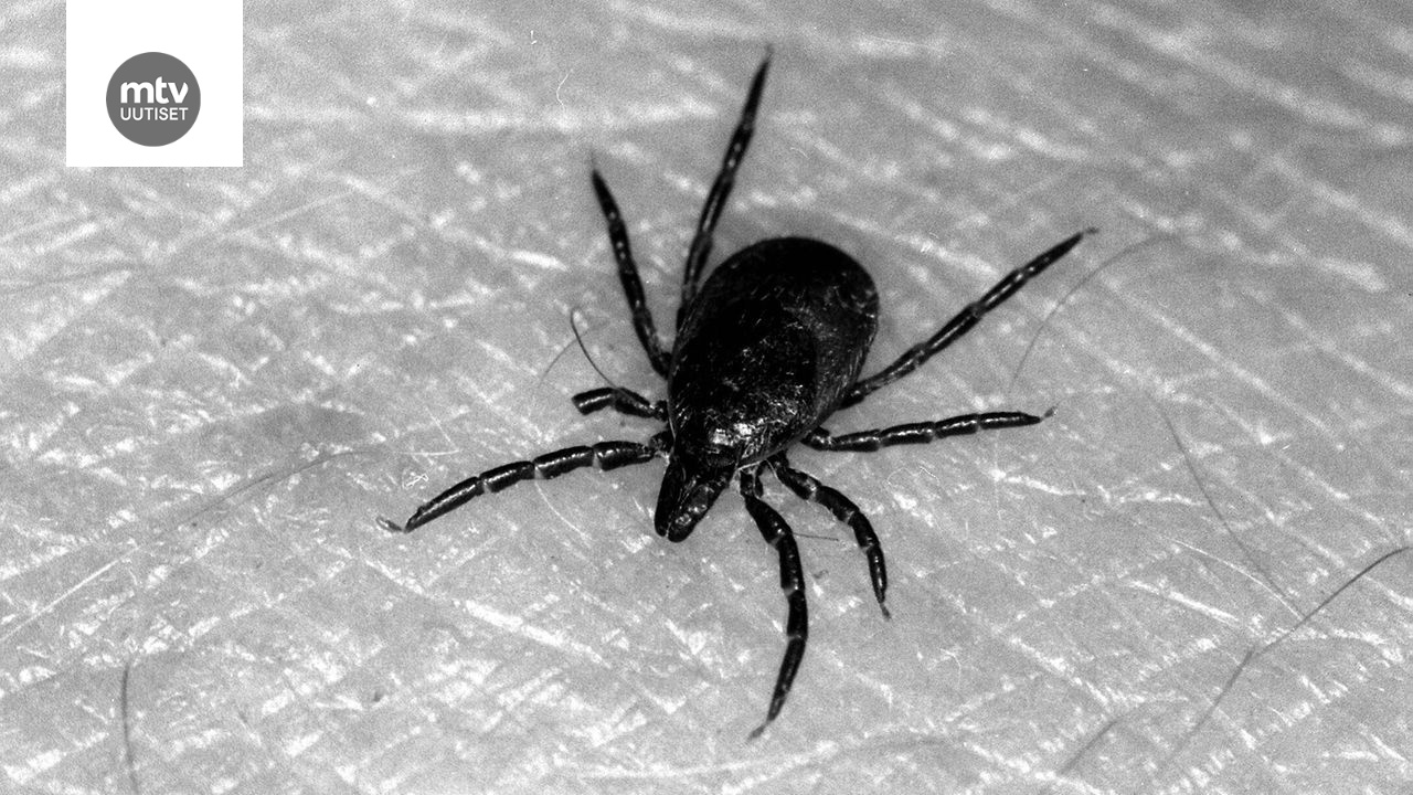 Punkki puri, naiselta amputoitiin kaikki raajat | MTV Uutiset