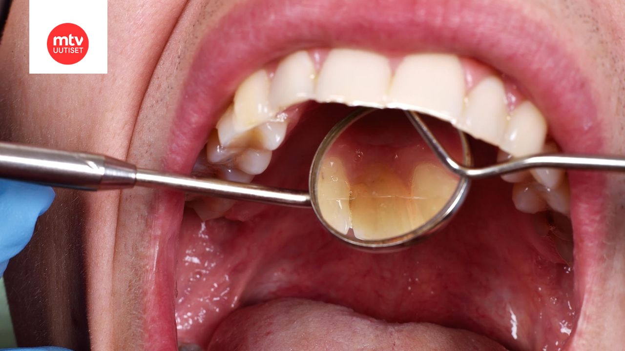 Ientulehdus on salakavala ja vaarallinen – näin ehkäiset, tunnistat ja ...