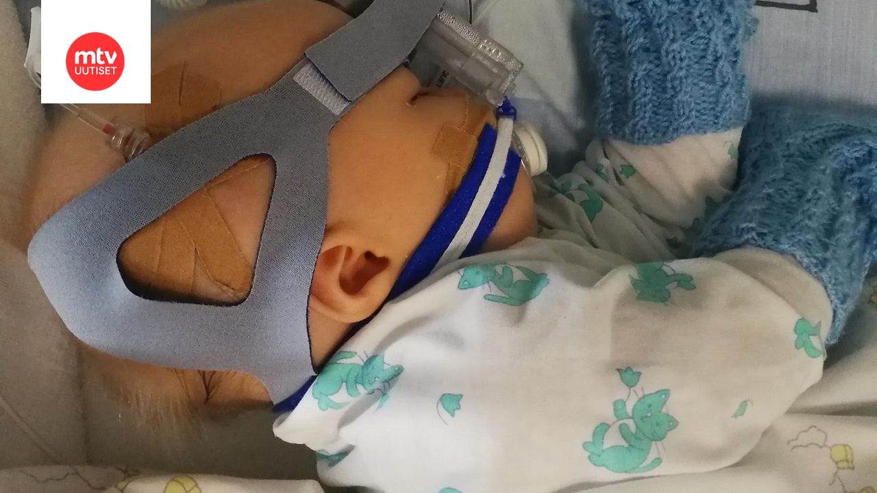 Tavallinen lastentauti vei 10 kuukauden ikäisen Miro-vauvan teho ...