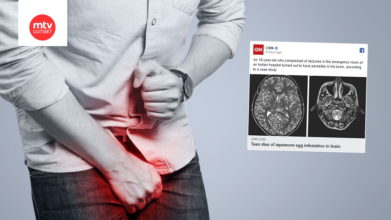 Teini valitti kipua nivusissaan ja sai kouristuskohtauksen – aivokuvaus ...