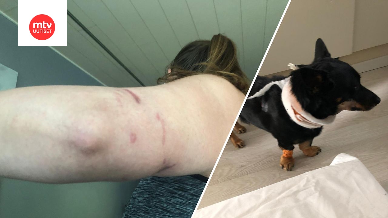 Vääriin käsiin päätynyt rescue-koira raateli Kukan käsivarren ja ...