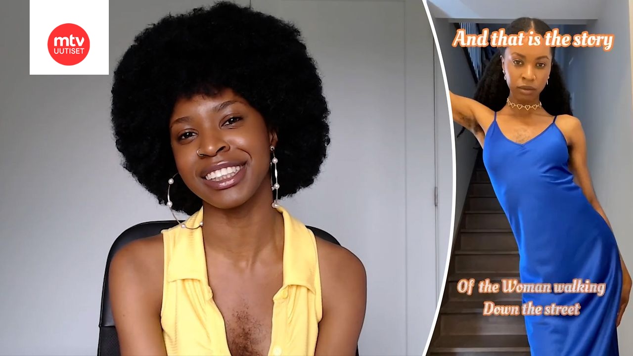 Queen Esie on nainen, joka ei sheivaa ihokarvojaan | MTV Uutiset