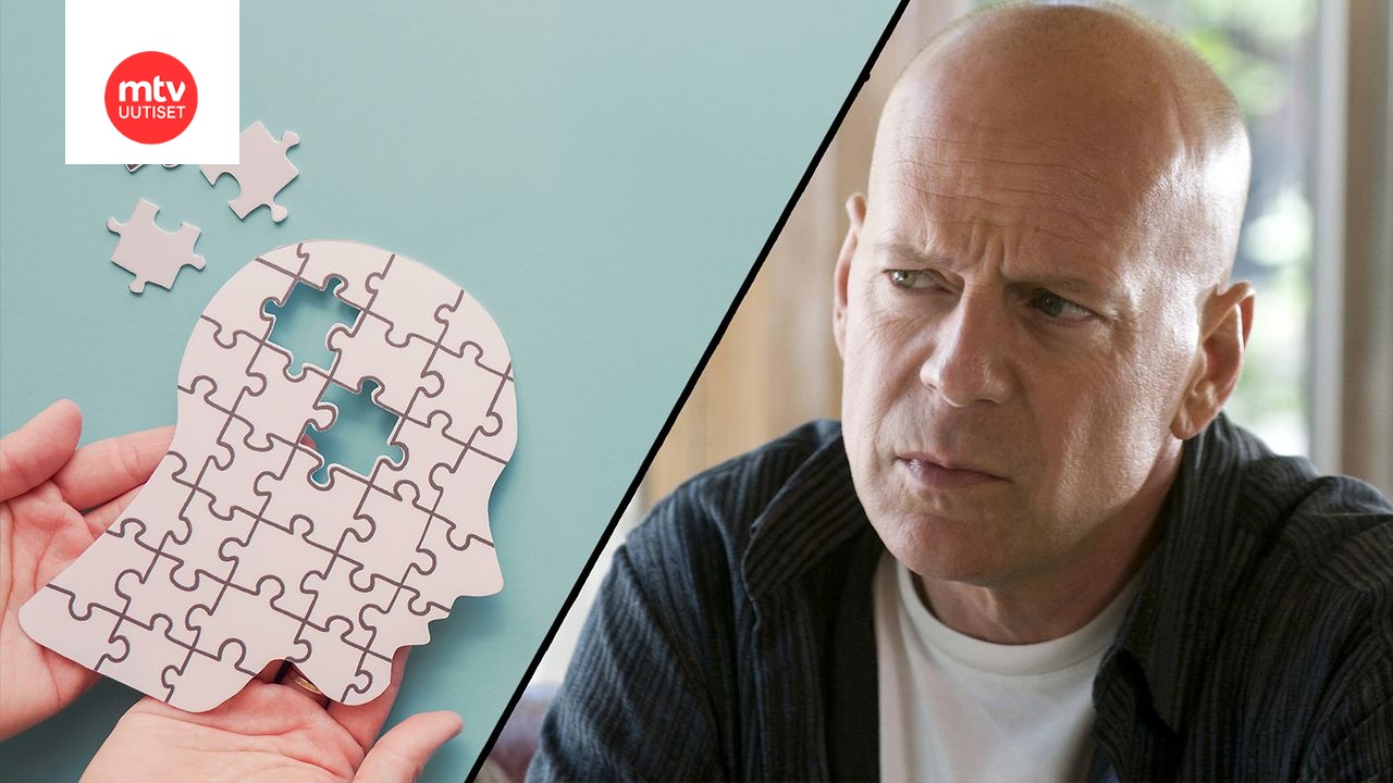 Bruce Willisillä muistisairaus – näin oireilee frontotemporaalinen ...