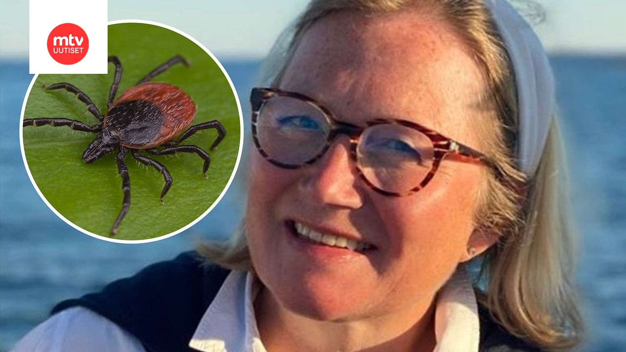 Punkin pureman aiheuttama allergia ei koske vain lihaa | MTV Uutiset