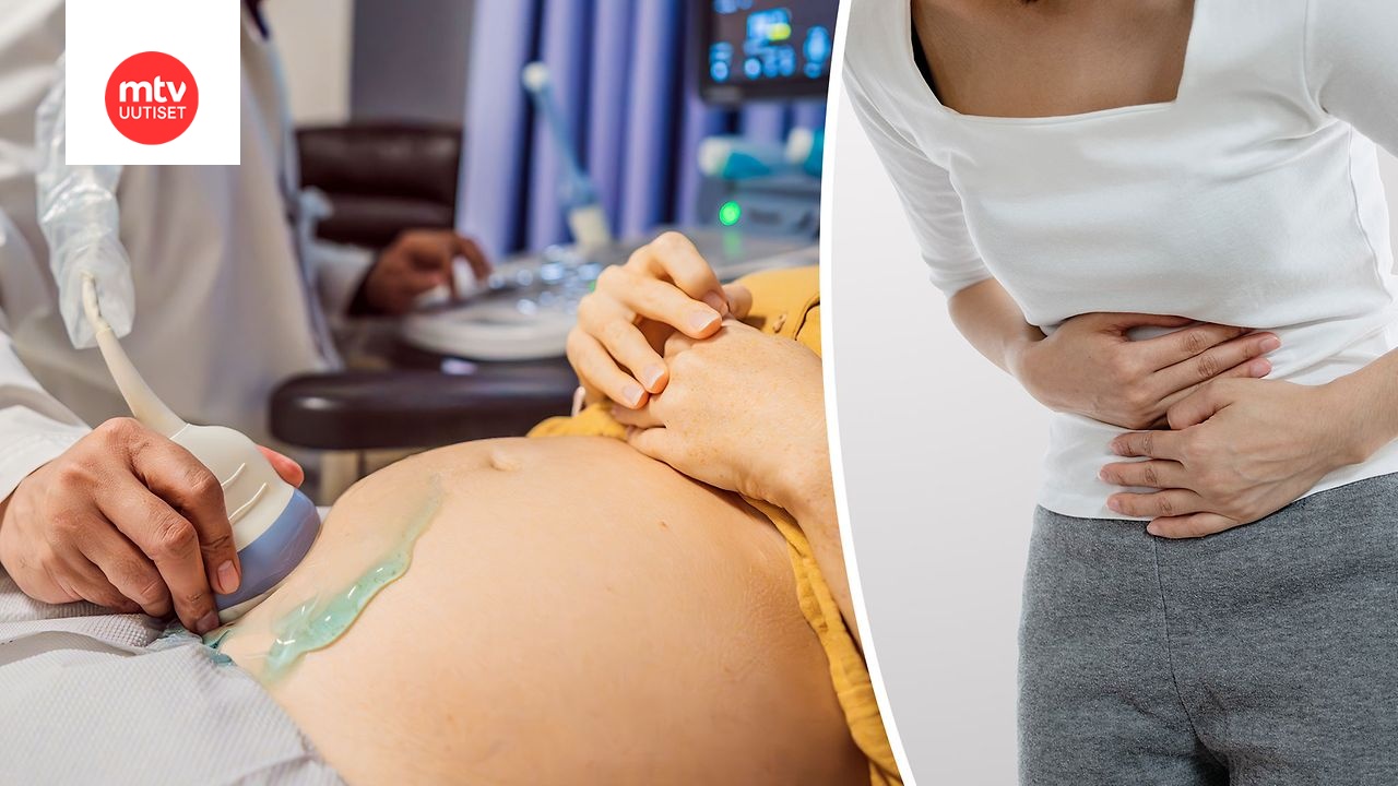 Naisen "vatsakipu" olikin kohdunulkoinen raskaus | MTV Uutiset