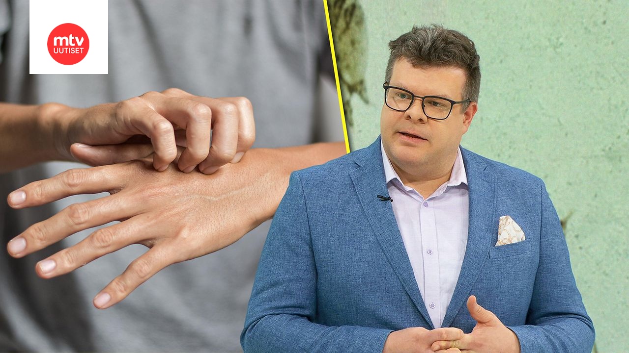 Syyhy voi tarttua seksissä | MTV Uutiset