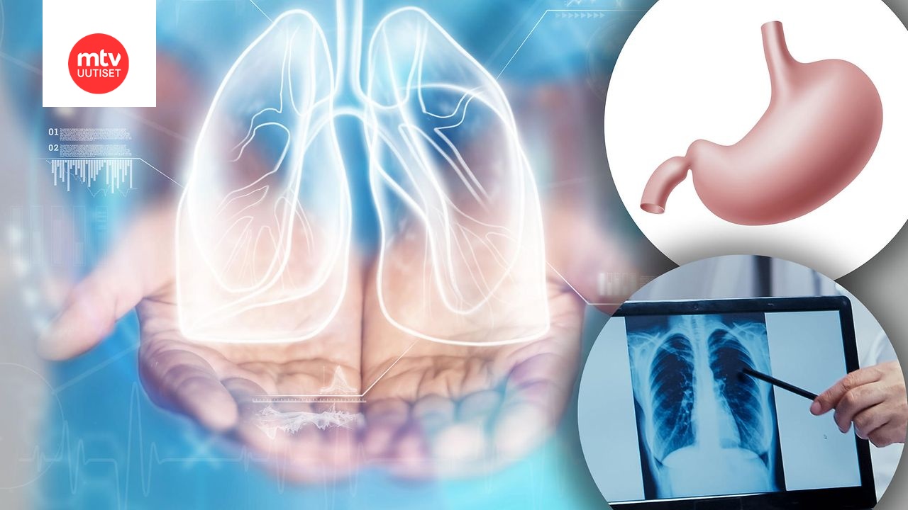 Keuhko ei ole tyhjä ilmapallo eikä mahalaukku ole laukku | MTV Uutiset