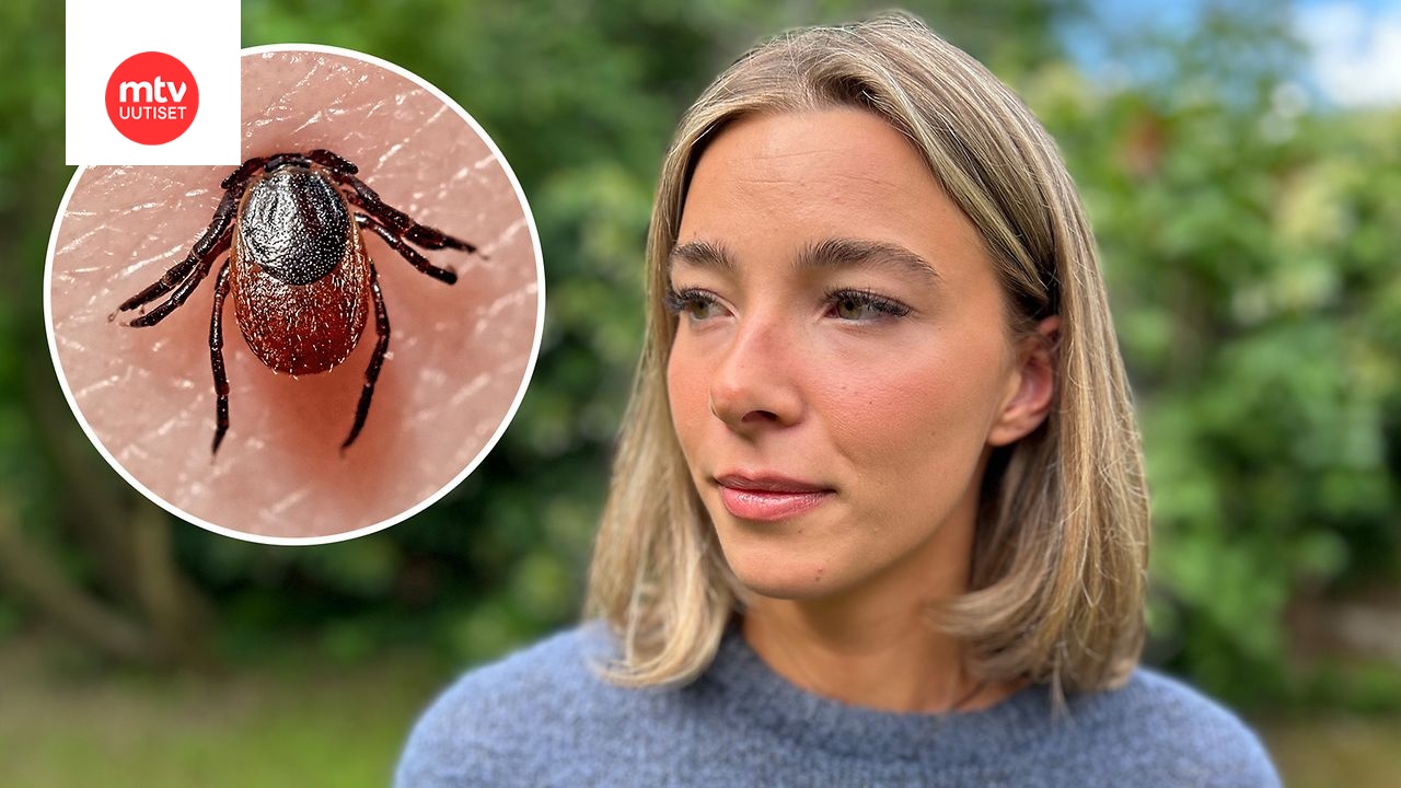 Punkin purema vei 19-vuotiaan Jennyn tehohoitoon | MTV Uutiset