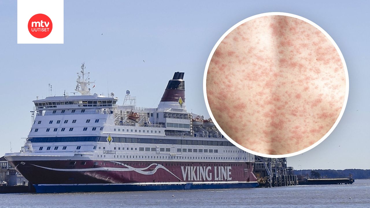 Tuhkarokkoon sairastunut matkusti laivalla Tallinnasta Helsinkiin | MTV ...