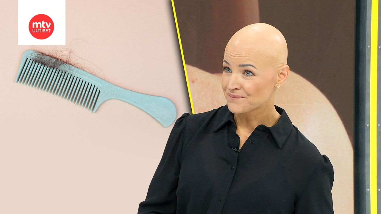 Anne Vainiolla on alopecia universalis | MTV Uutiset